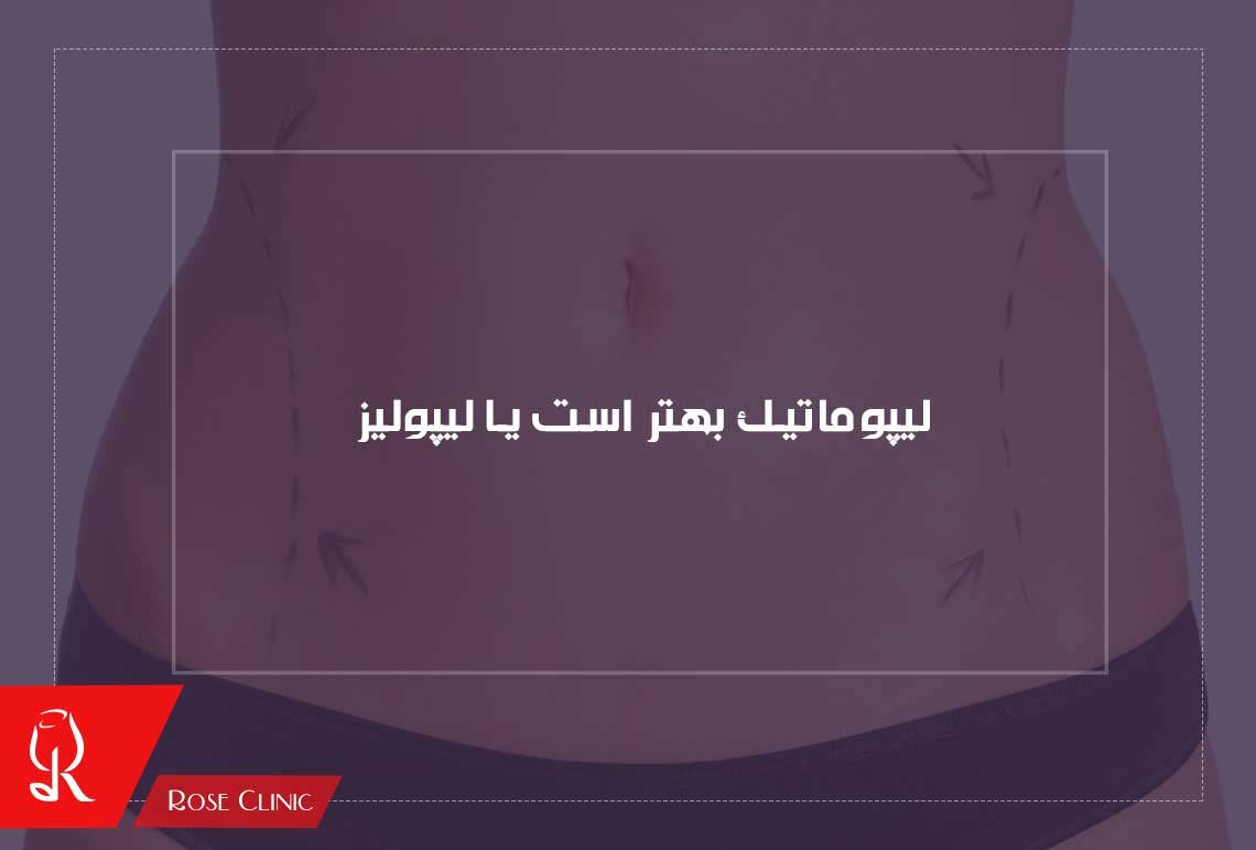 لیپوماتیک و تزریق چربی همزمان | کلینیک رز