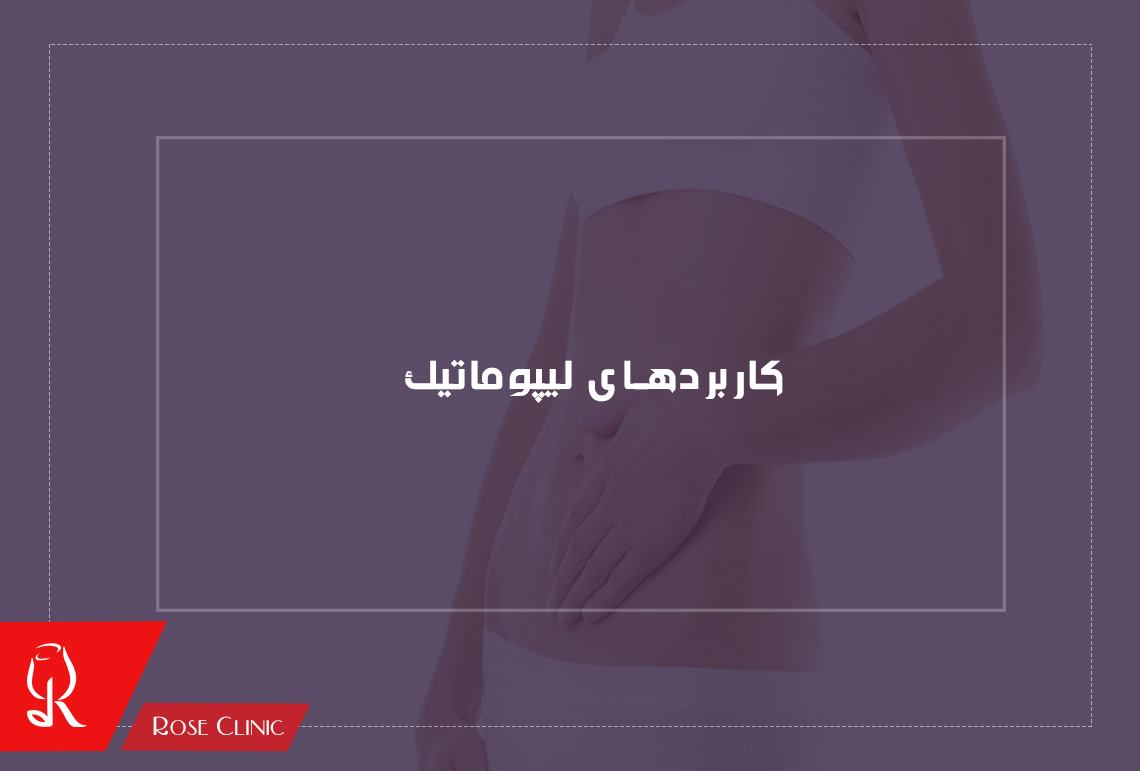 آمادگی های لازم برای عمل لیپوماتیک چیست؟ | کلینیک رز
