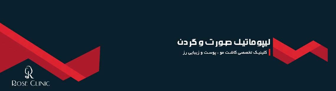 لیپوماتیک صورت و گردن و فواید آن • کلینیک رز