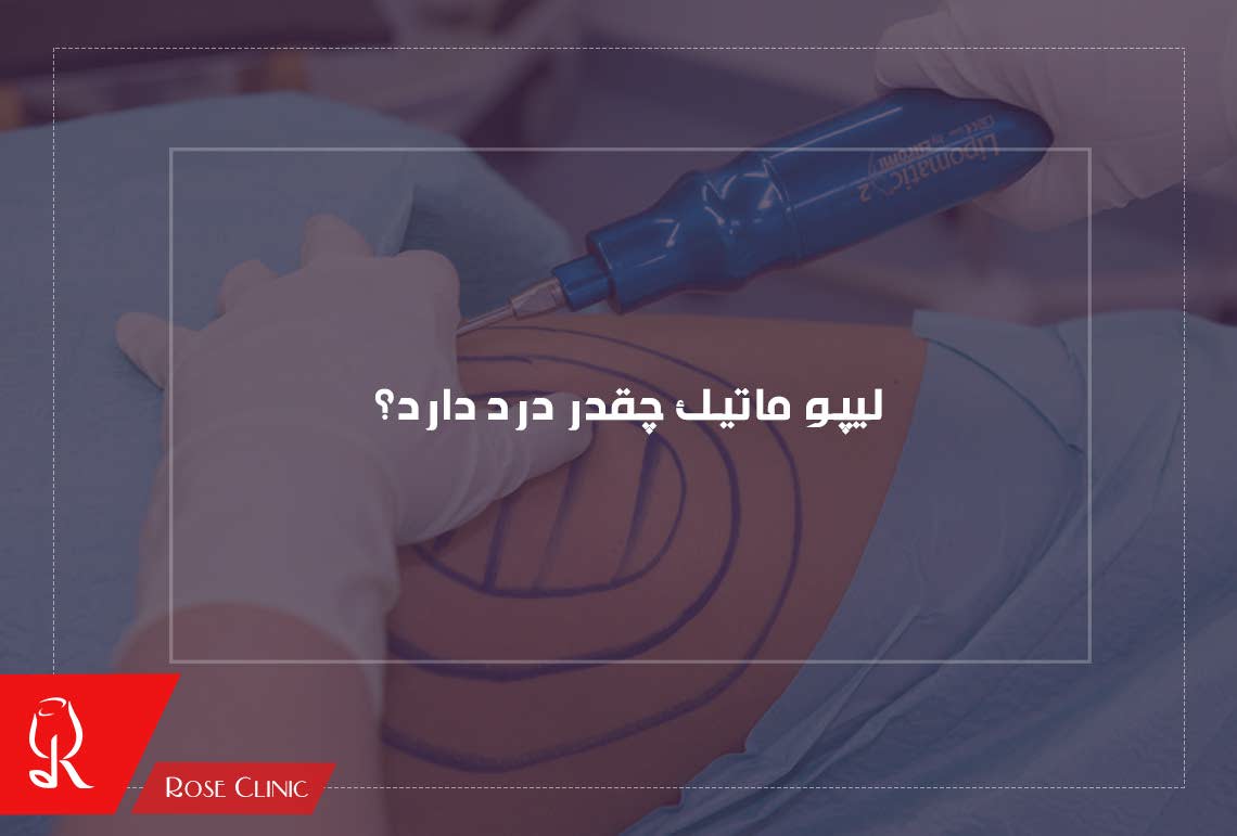 مراقبت های بعد از لیپوماتیک | کلینیک رز