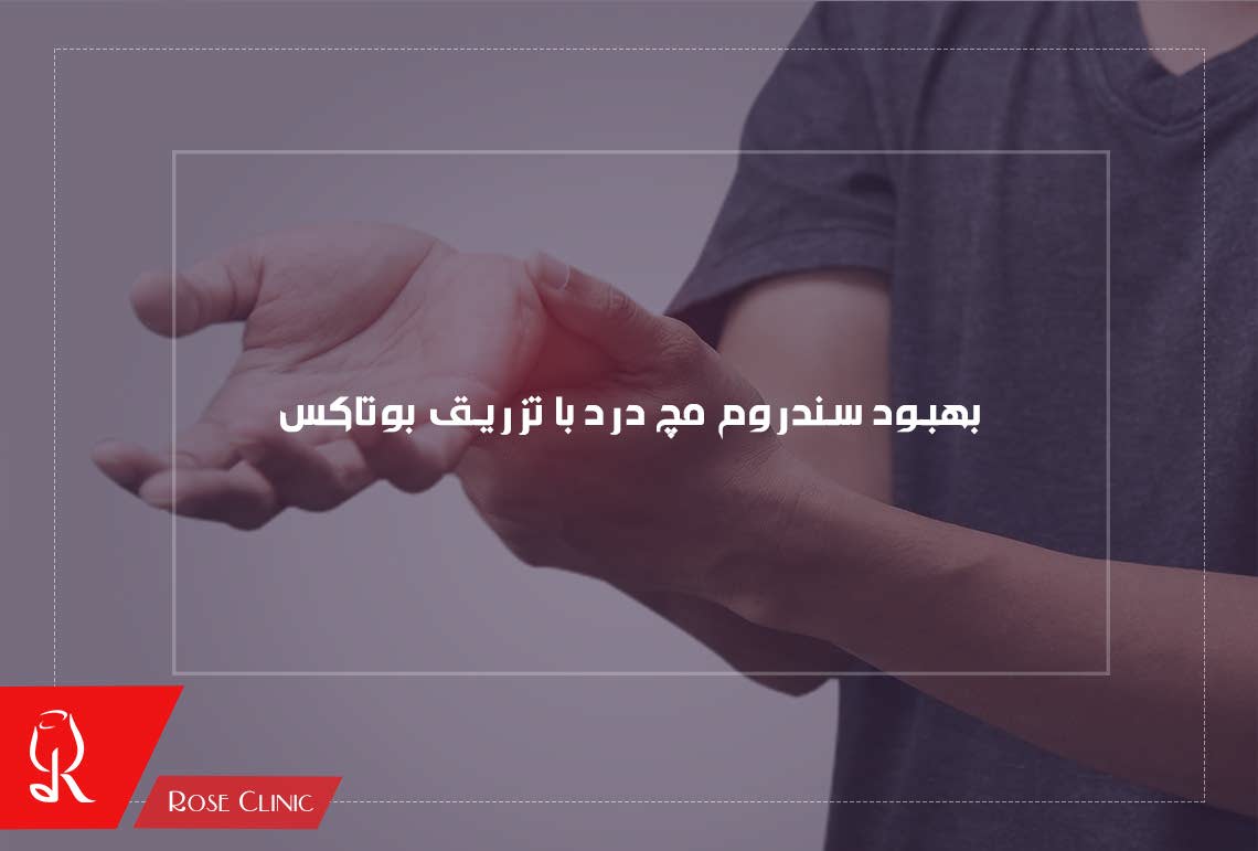 بهبود سندروم مچ درد با تزریق بوتاکس • کلینیک رز