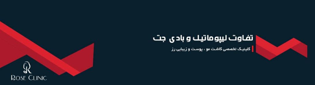 تفاوت لیپوماتیک و بادی جت در چیست؟ • کلینیک رز