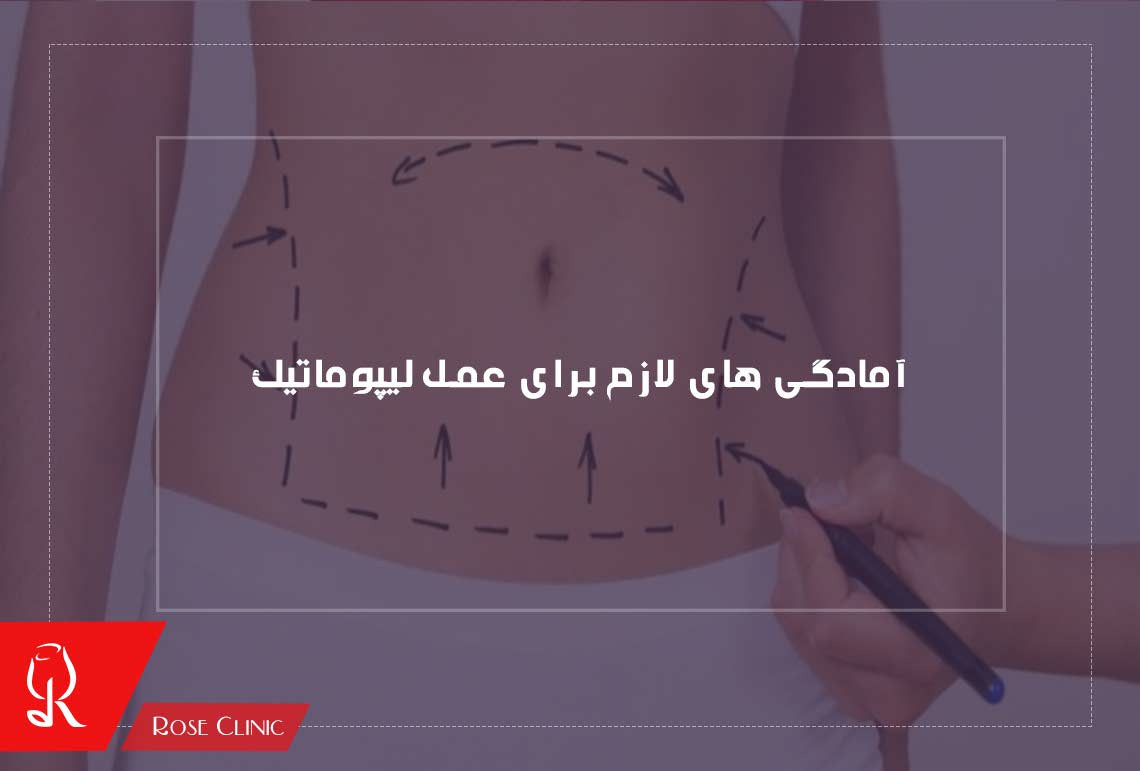 آمادگی های لازم برای عمل لیپوماتیک چیست؟ • کلینیک رز